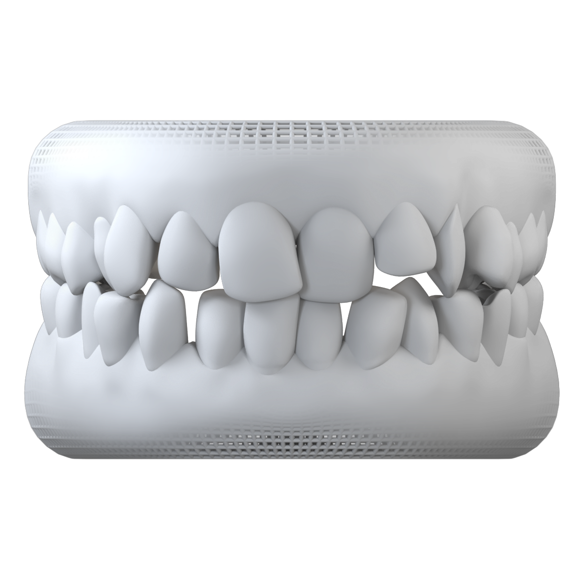 Alineadores moons: la forma más fácil de alinear tus dientes